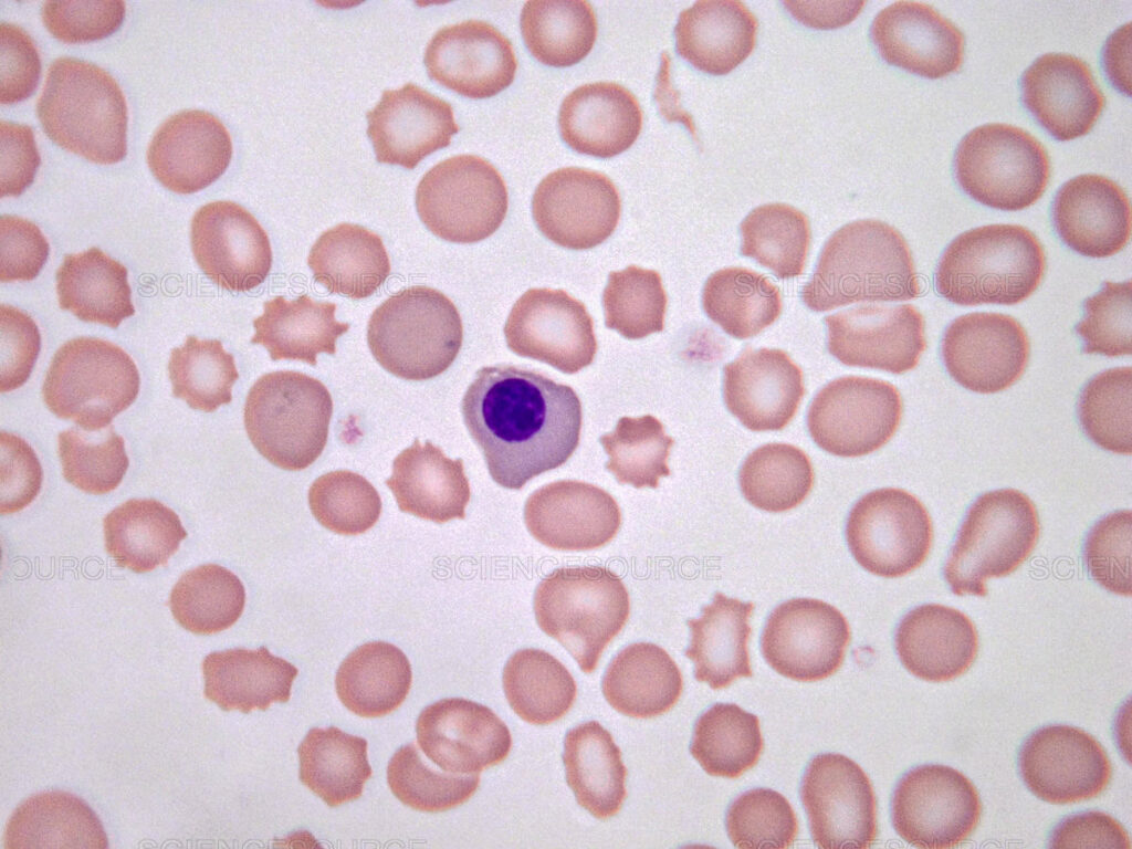 Nucleated red blood cell - تریتا آکادمی